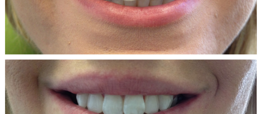 Woodbridge Dental | Woodbridge Dentist | Dentist Woodbridge | Dr ...